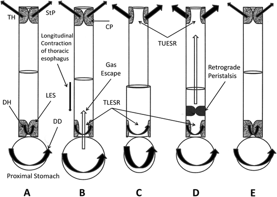 The Physiology of Eructation | SpringerLink