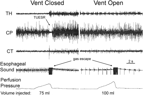 The Physiology of Eructation | SpringerLink