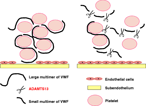 Thrombotic thrombocytopenic purpura related to severe ADAMTS13 deficiency in children | SpringerLink