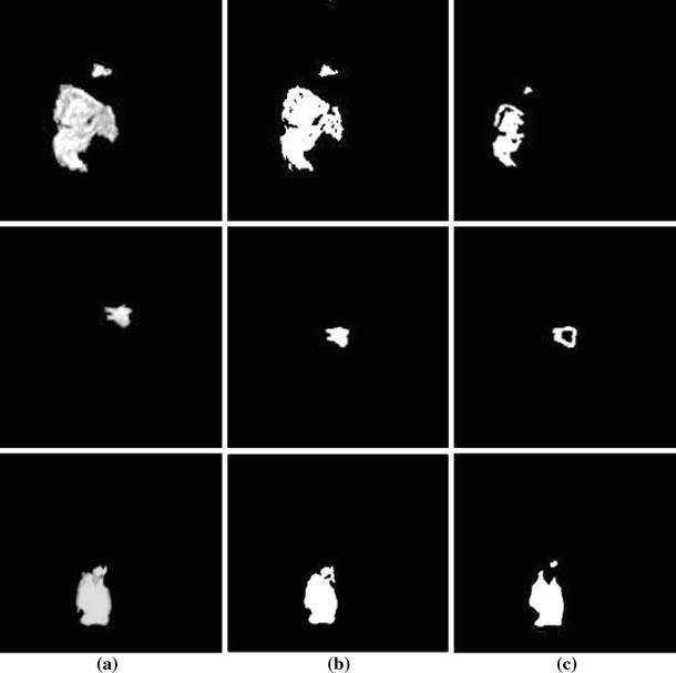 Adaptive k-means clustering algorithm for MR breast image segmentation | SpringerLink