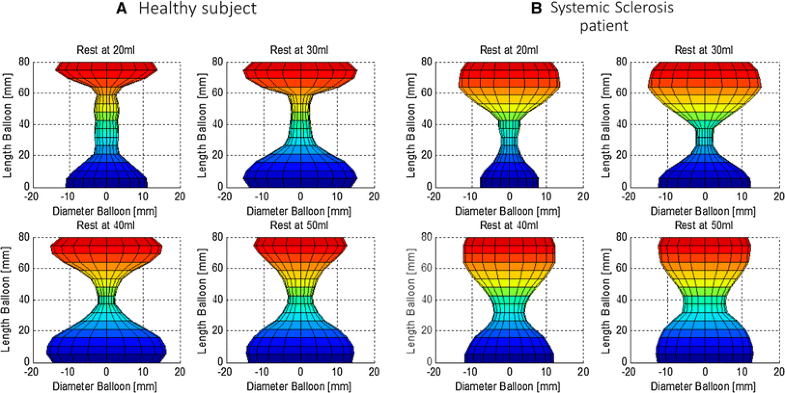 Functional lumen imaging of the gastrointestinal tract | SpringerLink