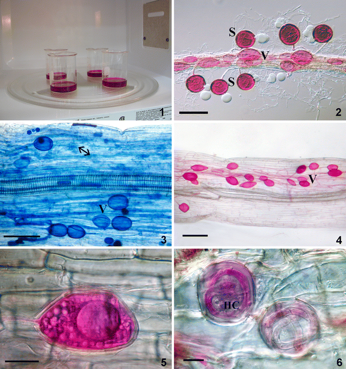 Microwave-assisted technology for the clearing and staining of ...