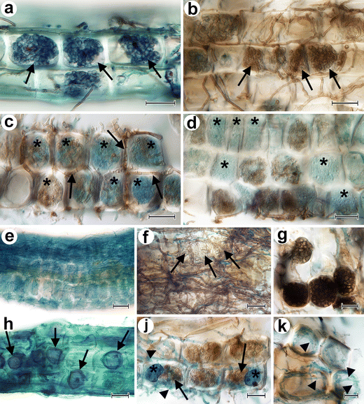 Is the prominent ericoid mycorrhizal fungus Rhizoscyphus ericae absent ...