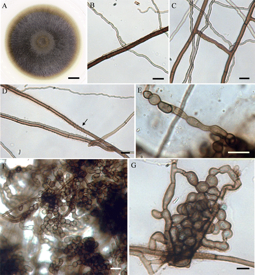 Revisiting phylogenetic diversity and cryptic species of Cenococcum ...