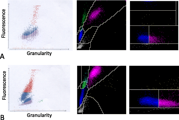 Comparison of the ProCyte Dx analyzer with the ADVIA 2120 and the ...