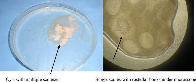 Prevalence and economic importance of Coenurus Cerebralis in sheep and ...