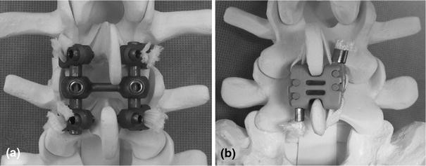Biomechanical evaluation of posterior lumbar dynamic stabilization: an ...