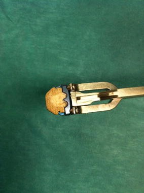 Zero-P: a new zero-profile cage-plate device for single and multilevel ...