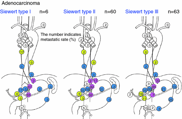 Lymph node metastasis from cancer of the esophagogastric junction, and ...