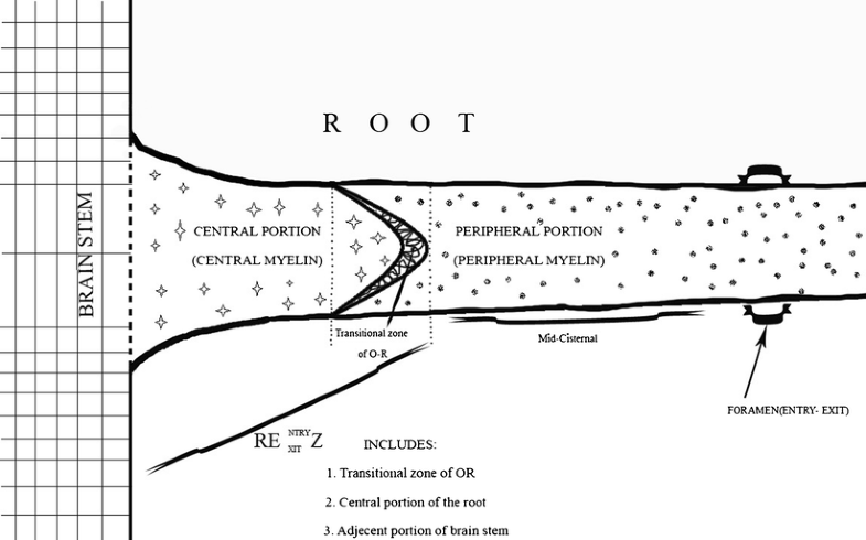Cranial nerve vascular compression syndromes of the trigeminal, facial ...