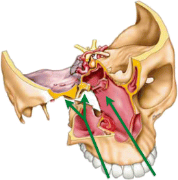 Combined endonasal and sublabial endoscopic transmaxillary approach to the pterygopalatine fossa ...