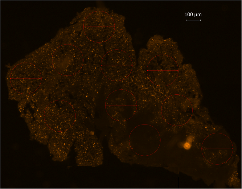 Comparison of commercial 5-aminolevulinic acid (Gliolan®) and the ...