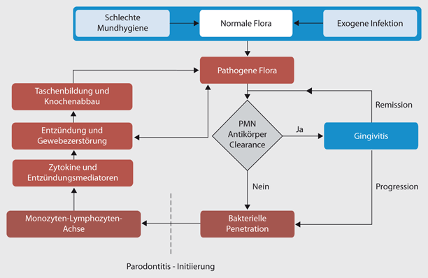 Pathogenese der Parodontitis bei rheumatischen Erkrankungen | SpringerLink