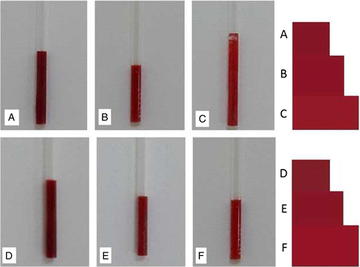 Pulp bleeding color is an indicator of clinical and histohematologic ...