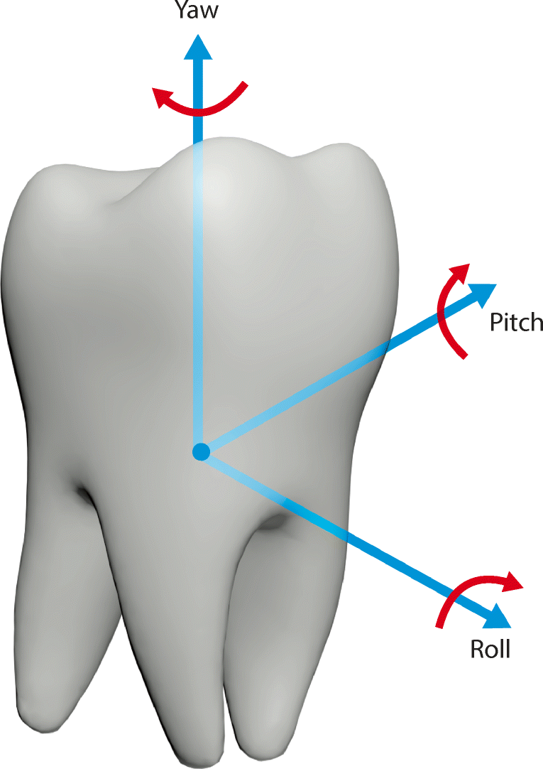 Virtual setup in orthodontics: planning and evaluation | SpringerLink