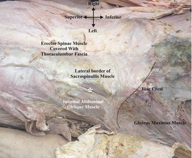 The clinical anatomy of the triangle of Grynfeltt | SpringerLink