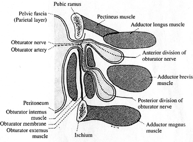 Obturator hernia: the relationship between anatomical classification ...