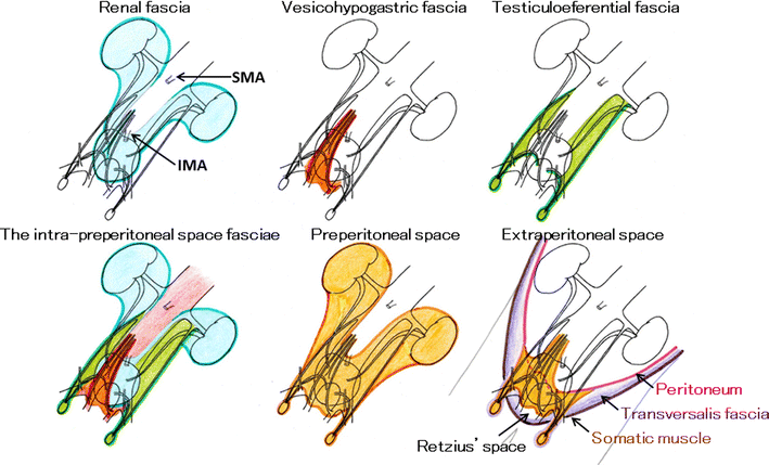 Paradigm shift regarding the transversalis fascia, preperitoneal space ...