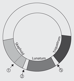 Begutachtung der SL- und LT-Band-Schäden | SpringerLink