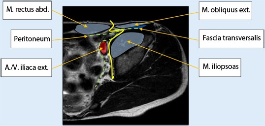 Der pararektale Zugang | SpringerLink