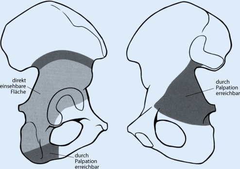Acetabulumfrakturen | SpringerLink
