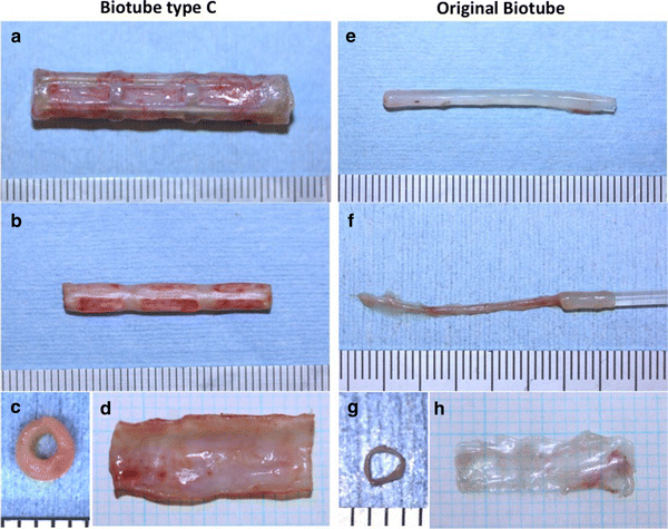 Development of an in vivo tissue-engineered vascular graft with ...