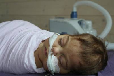 Nichtinvasive Beatmung bei Kindern mit akuter respiratorischer ...