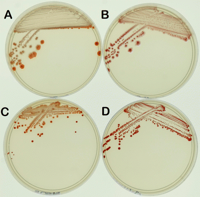 Comparison of culture media for detection of Acinetobacter baumannii in ...