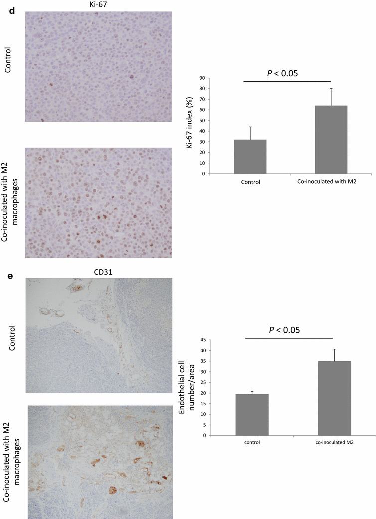 Tumor-associated macrophages of the M2 phenotype contribute to ...