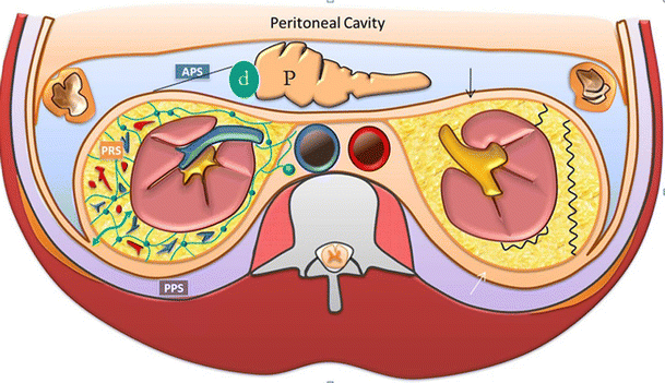 Acute conditions affecting the perinephric space: imaging anatomy ...