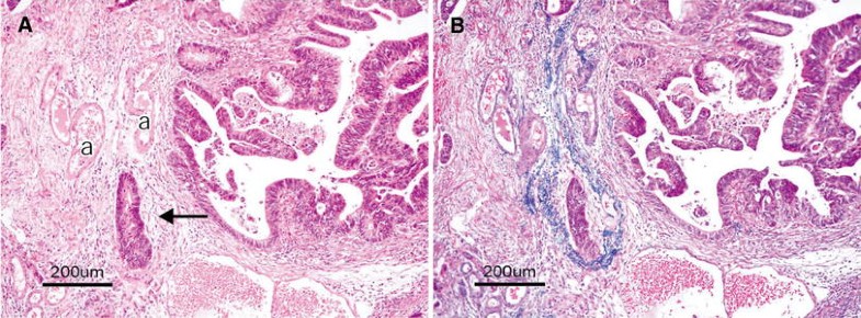 Japanese Society for Cancer of the Colon and Rectum (JSCCR) guidelines ...