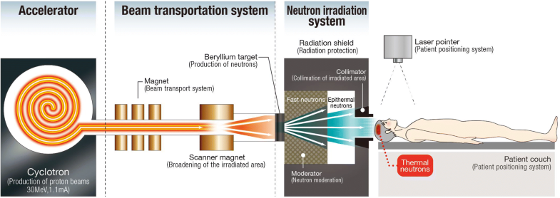 Boron neutron capture therapy (BNCT): a unique role in radiotherapy with a view to entering the ...