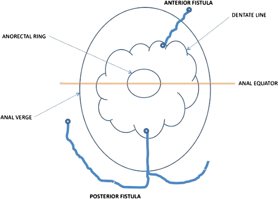 David Henry Goodsall: reassessment of the rule | SpringerLink