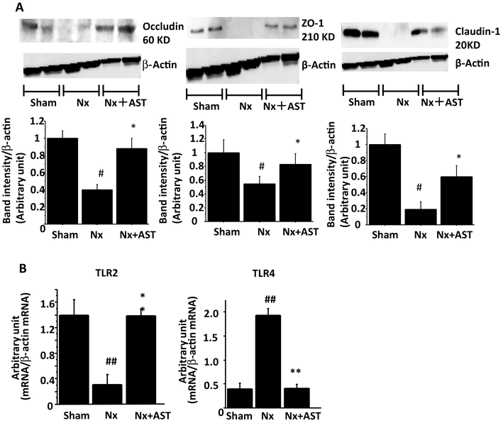 Oral adsorbent AST-120 ameliorates gut environment and protects against ...