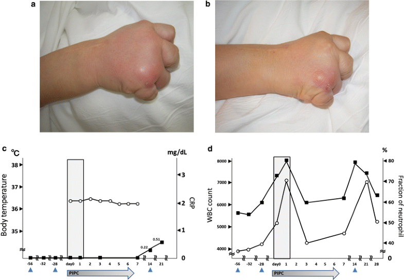 Diagnostic features of mild cellulitis phlegmon in patients with ...