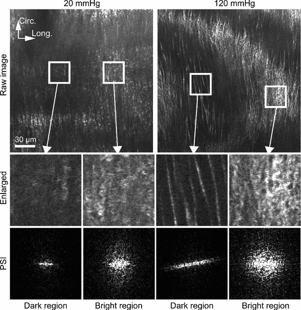 Multiphoton microscopy observations of 3D elastin and collagen fiber ...