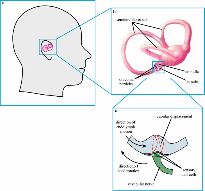 Numerical modeling of the cupular displacement and motion of otoconia ...