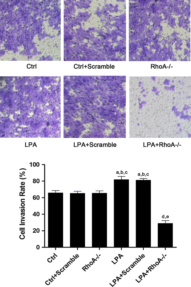 Curcumin inhibits LPA-induced invasion by attenuating RhoA/ROCK/MMPs ...