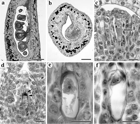 Development and structure of the female gametophyte in Austrobaileya ...