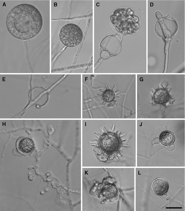 Phylogeny of the genus Pythium and description of new genera | SpringerLink