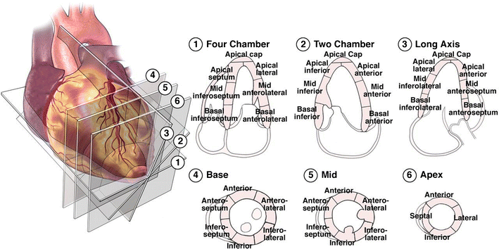 Automatic Classification of Left Ventricular Regional Wall Motion ...