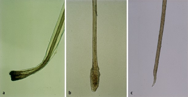 Einfluss von HRT auf Haut und Haare | SpringerLink