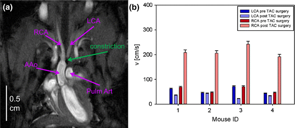 Velocity mapping of the aortic flow at 9.4 T in healthy mice and mice ...