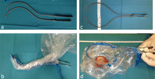 Complete plastic lining of the abdominal cavity during laparoscopic ...