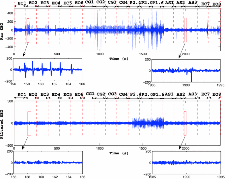 Identification Of Resting And Active State Eeg Features Of Alzheimer S