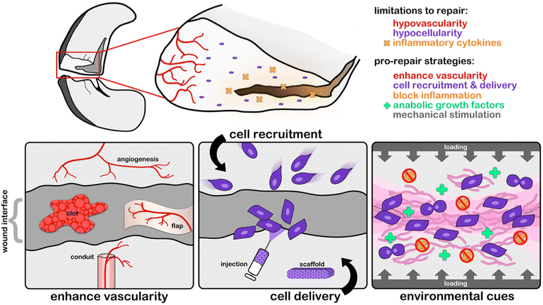 From Repair to Regeneration: Biomaterials to Reprogram the Meniscus ...