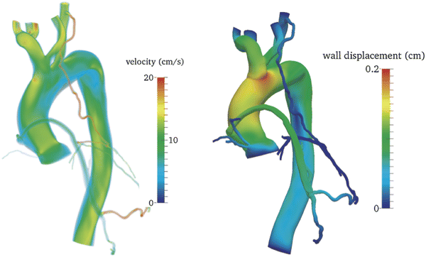 SimVascular: An Open Source Pipeline for Cardiovascular Simulation | SpringerLink