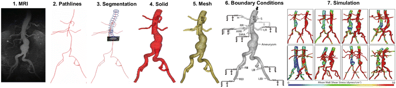 SimVascular: An Open Source Pipeline for Cardiovascular Simulation ...