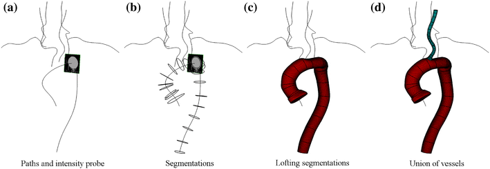 SimVascular: An Open Source Pipeline for Cardiovascular Simulation ...
