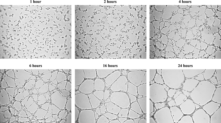 The endothelial cell tube formation assay on basement membrane turns 20 ...